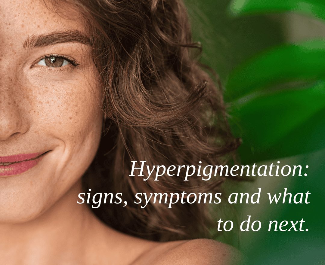 Hyperpigmentation: Signs, Symptoms and What To Do Next - Vemel