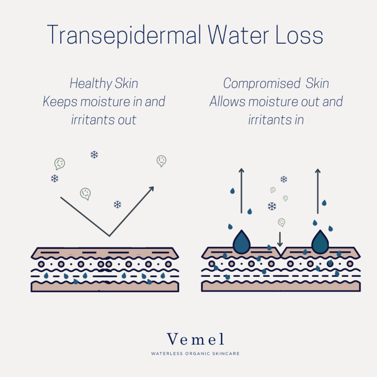 Transepidermal Water Loss - What It Is and How to Stop It - Vemel